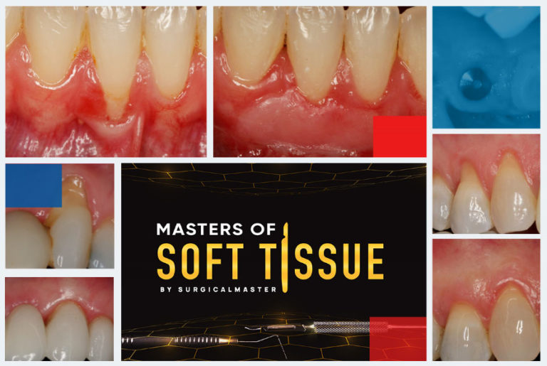 Masters of Soft Tissue | Surgical Master