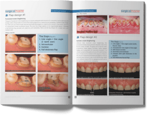 Flap Designs Book | Surgical Master