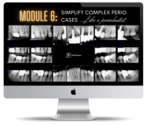 Perio Program Sales Page | Surgical Master