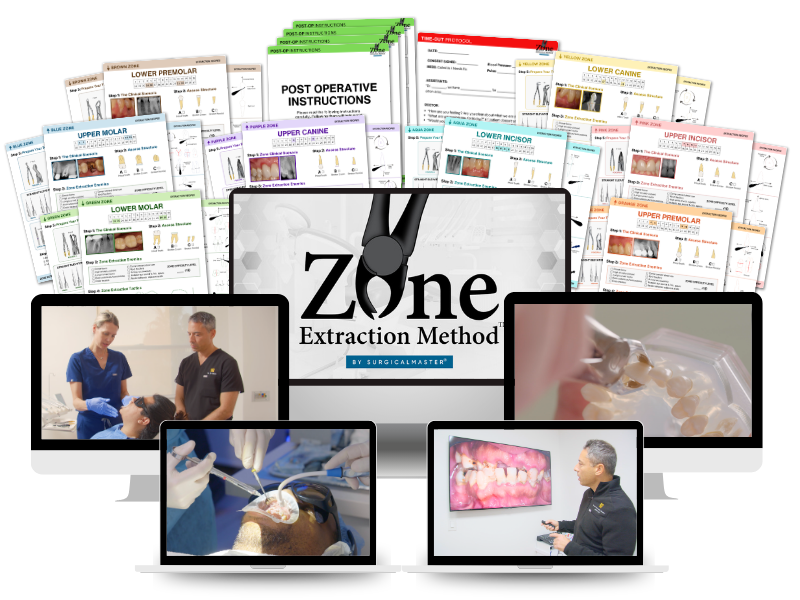 Zone Extraction Method | Surgical Master