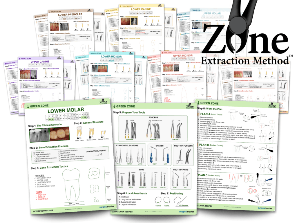 Zone Extraction Method | Surgical Master