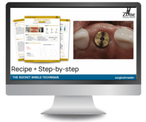 The Zone Extraction Method | Surgical Master