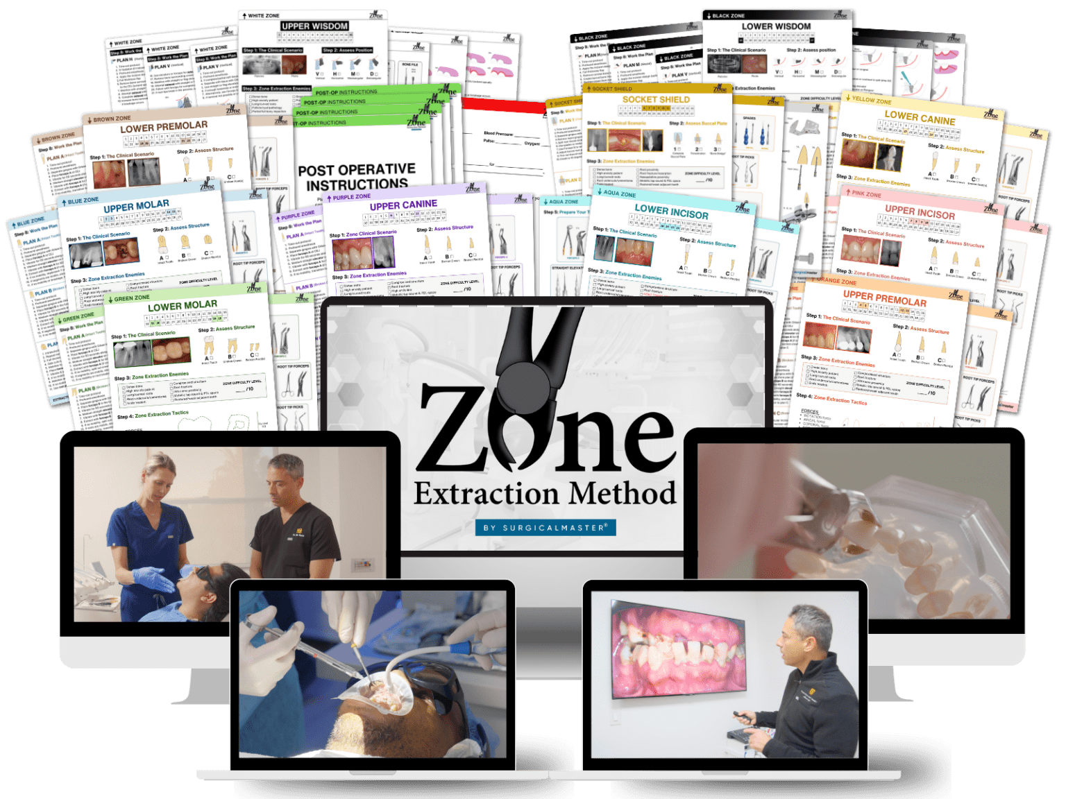 The Zone Extraction Method | Surgical Master