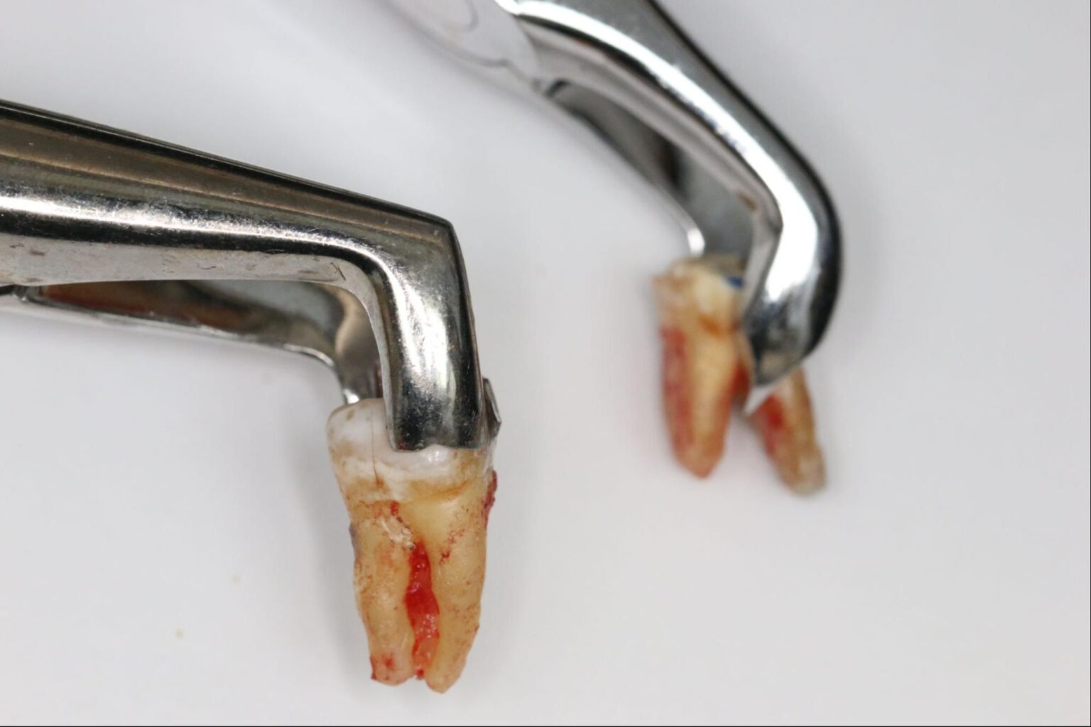 How to Extract Broken Teeth | Surgical Master